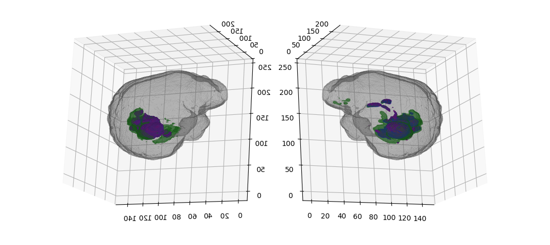 3-D Segmentation of Brain MRIs · James Braza